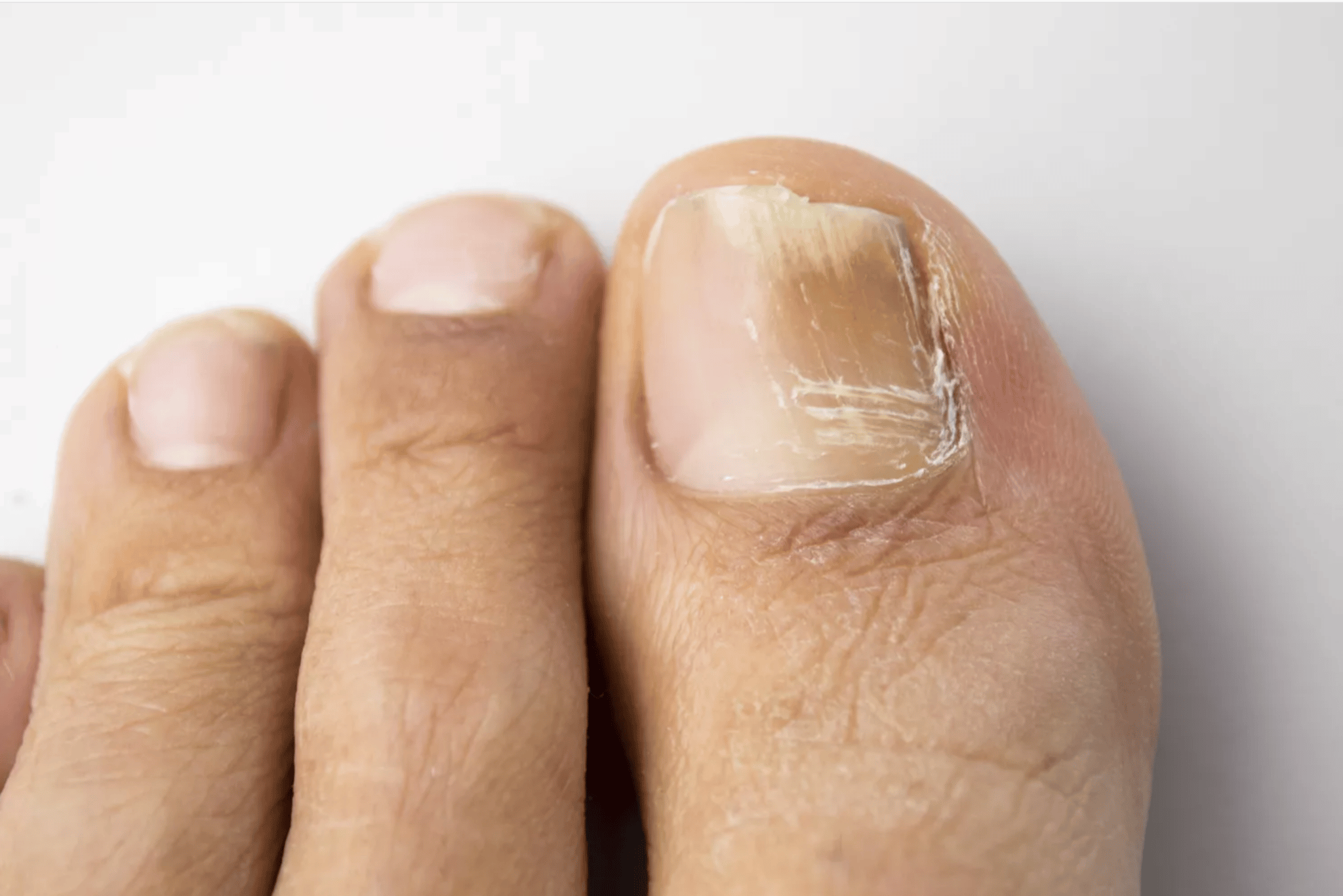 Waverley Clinic | Podiatry Clinic Farnham