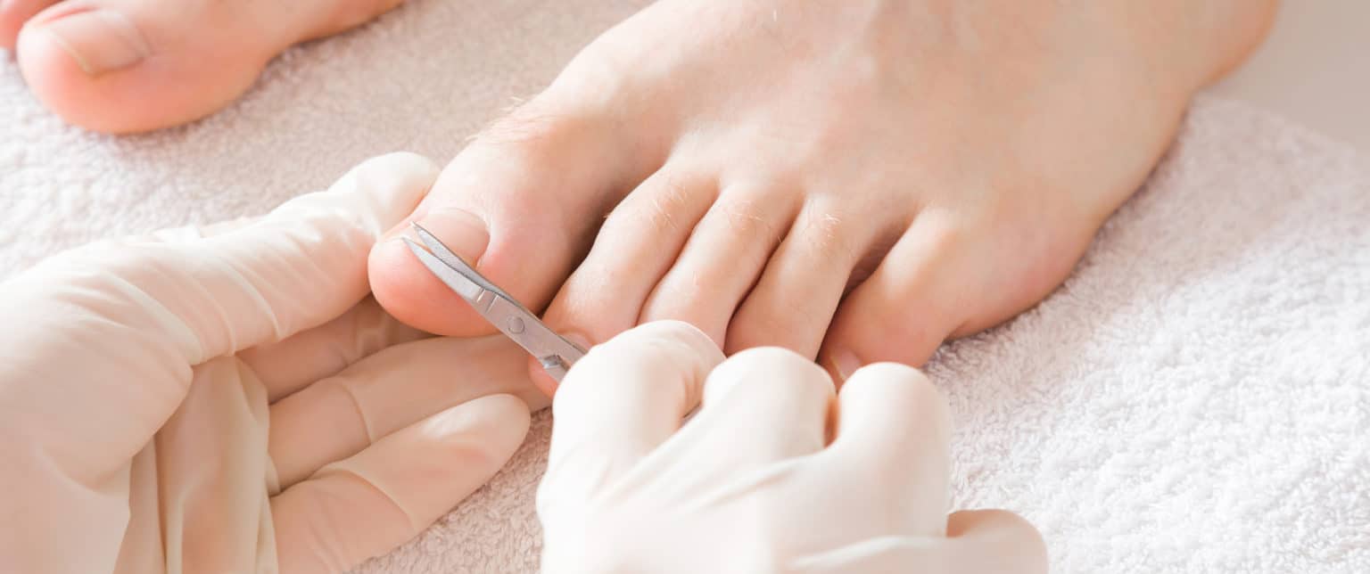 Unable to Cut Nails - Waverley Clinic